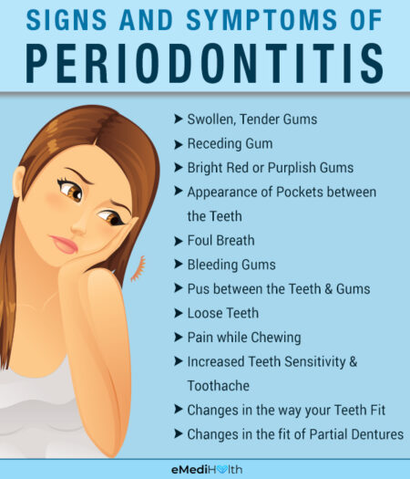 Periodontitis: Causes, Symptoms, Treatment, and Complications