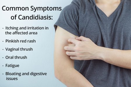 Candidiasis: Causes, Symptoms, Diagnosis, & Treatment